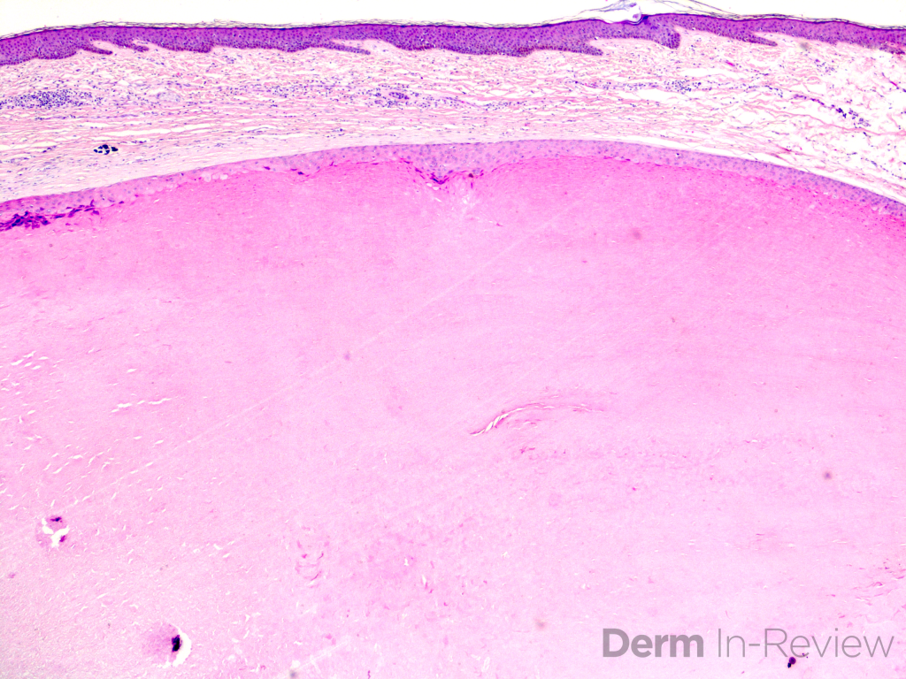 Figure 5.11.2 – Derm In-Review