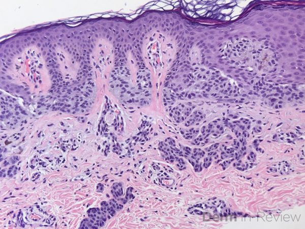 Figure 5.12.9 – Derm In-Review