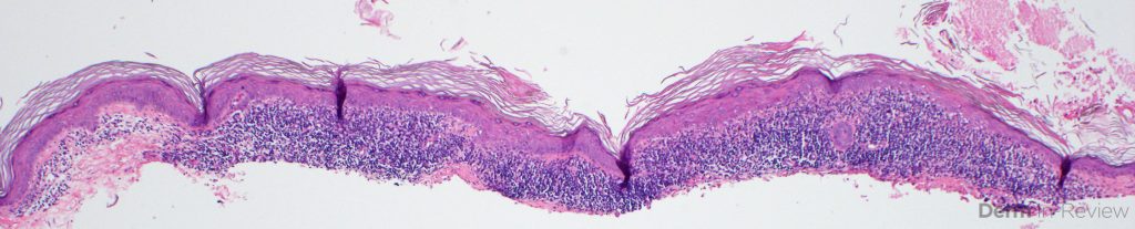 Figure 5.13.5 – Derm In-Review