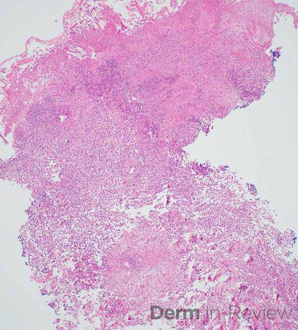 Figure 5.19.2 – Derm In-Review