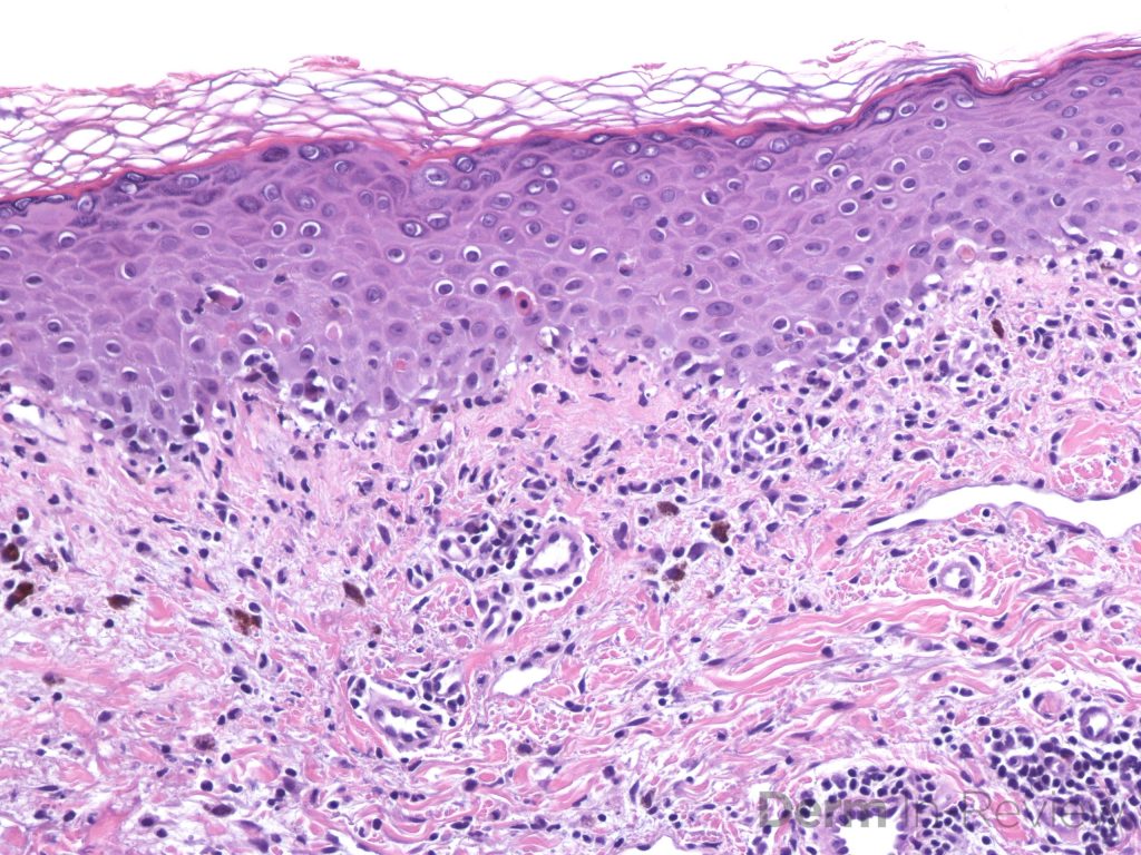 Figure 5.3.23 – Derm In-Review