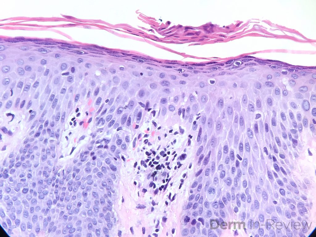 Figure 5.3.5 – Derm In-Review