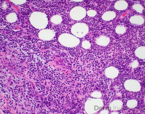 Figure 5.7.9 – Derm In-Review
