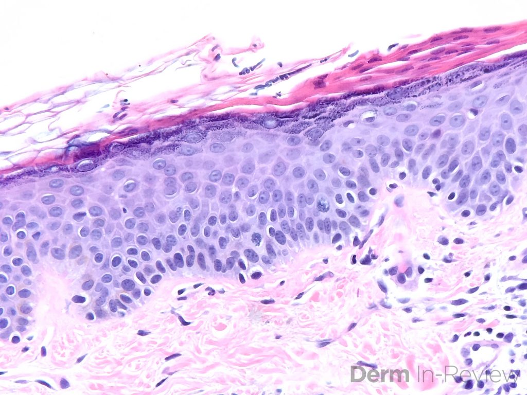 Figure 5.8.21 – Derm In-Review
