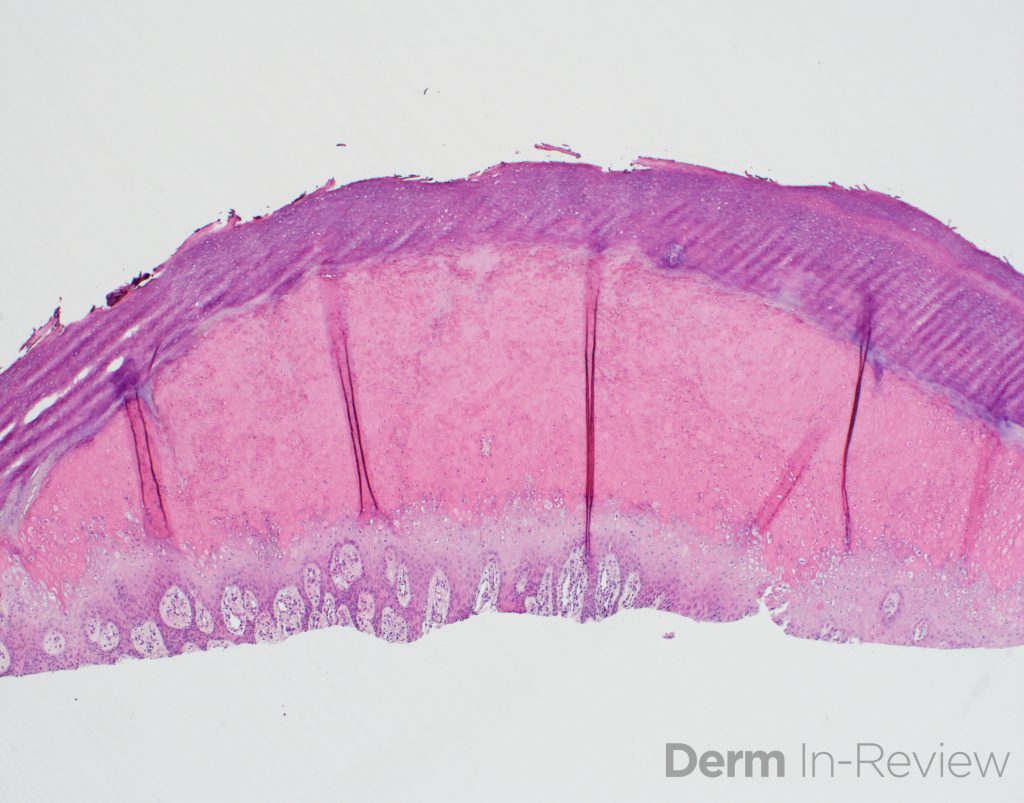 Figure 5.8.36A-B – Derm In-Review