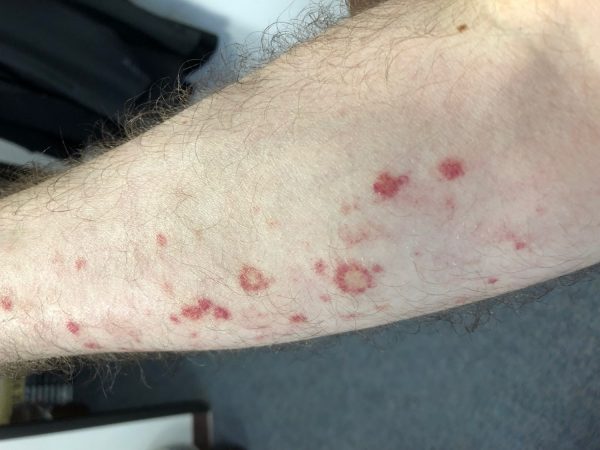 March 2020 Case Study – Derm In-Review