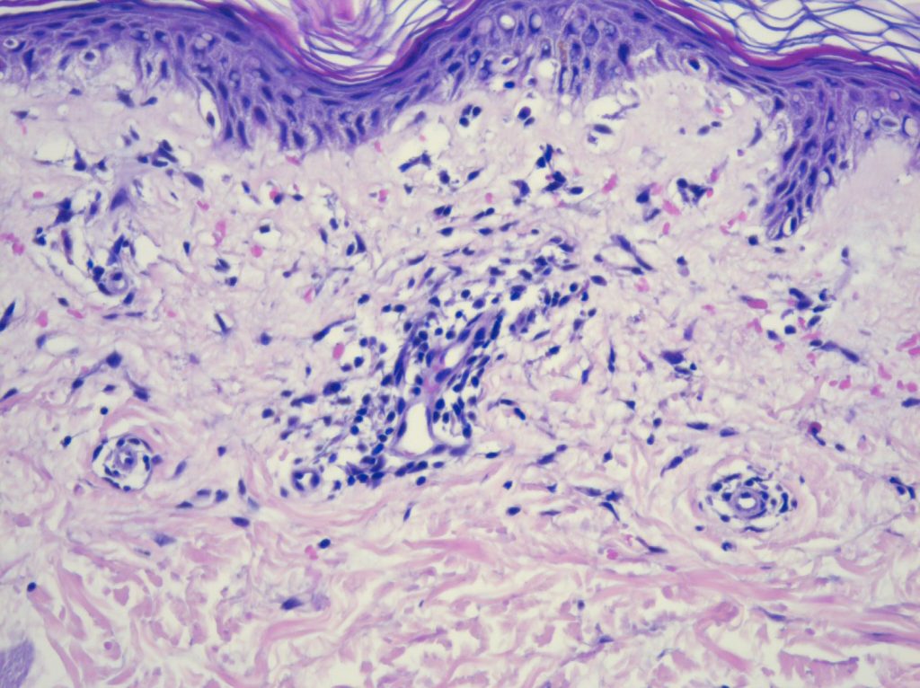 March 2020 Case Study – Derm In-Review