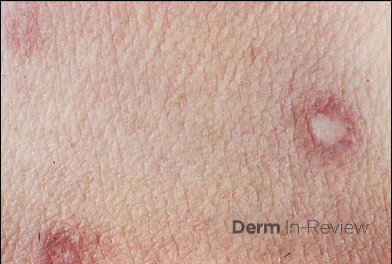April 2021 Case Study – Derm In-Review