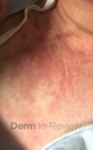 June 2021 Case Study – Derm In-Review