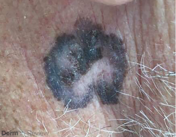 March 2021 Case Study – Derm In-Review