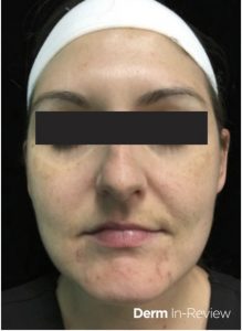 February 2021 Case Study – Derm In-Review