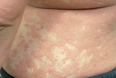 2021 Case Study of the Month Archives – Derm In-Review