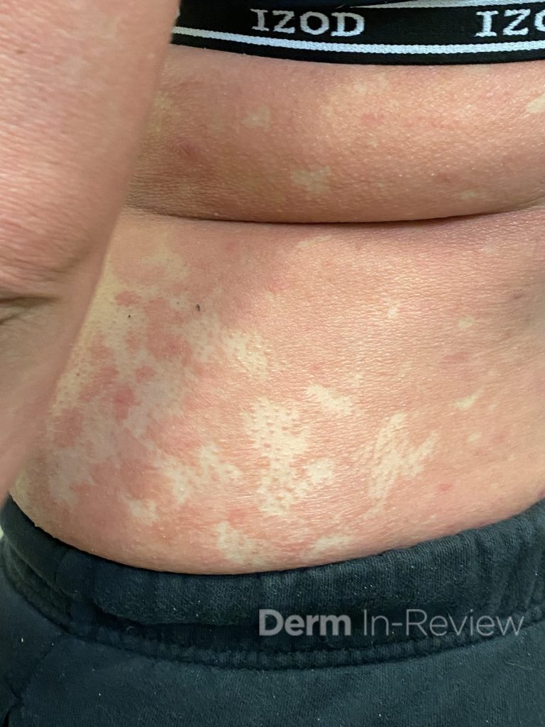 August 2021 Case Study – Derm In-Review