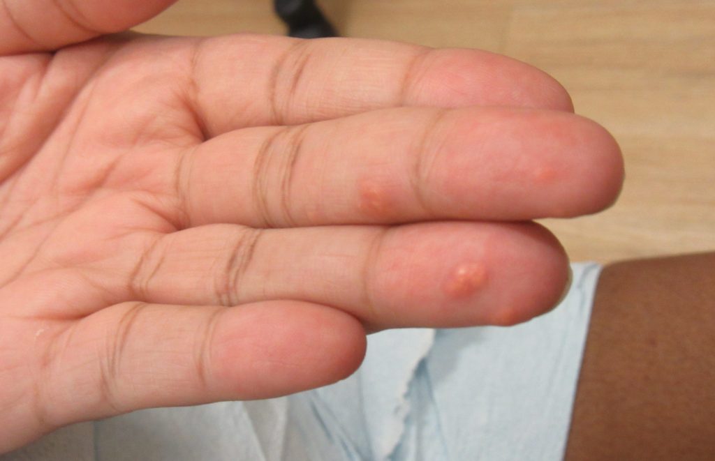 July 2021 Case Study – Derm In-Review