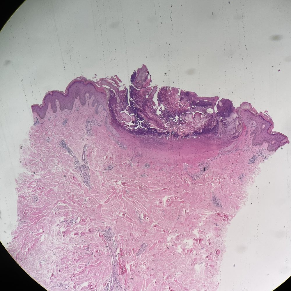 October 2022 Case Study – Derm In-Review