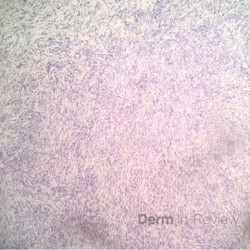 January 2023 Case Study – Derm In-Review