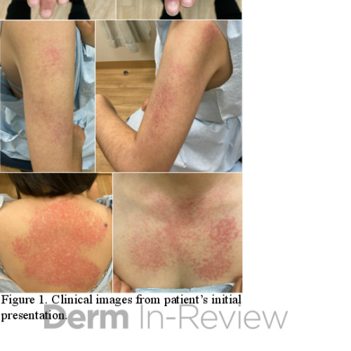 November 2022 Case Study – Derm In-Review