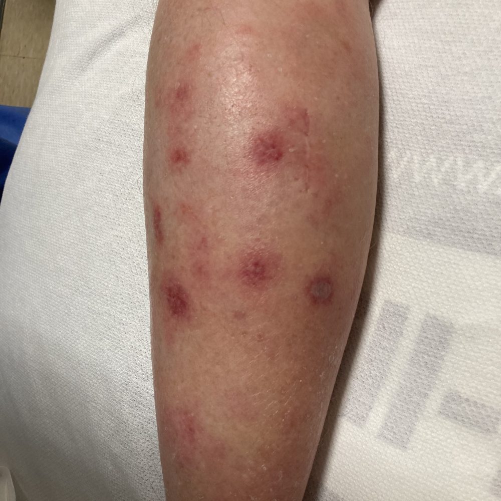 May 2023 Case Study – Derm In-Review