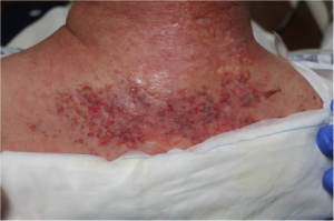 April 2024 Case Study – Derm In-Review