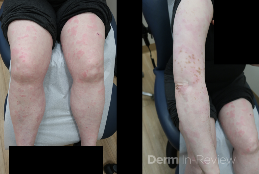 April 2025 Case Study – Derm In-Review