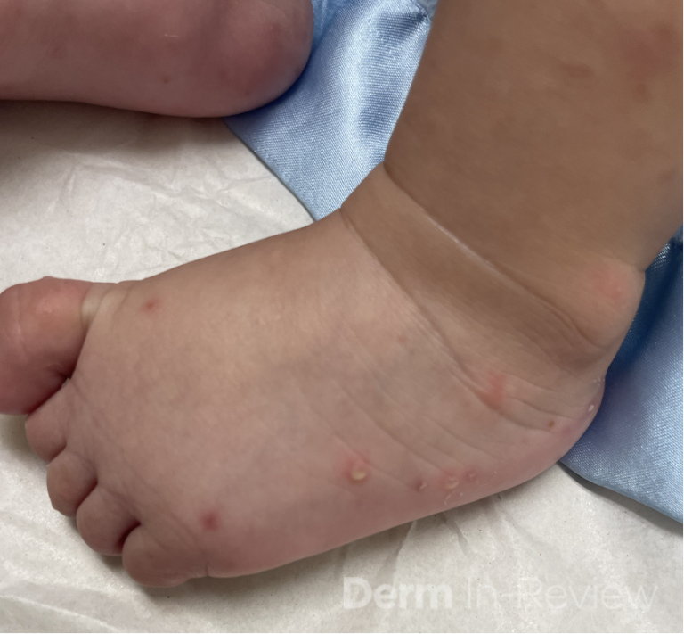 June 2025 Case Study – Derm In-Review