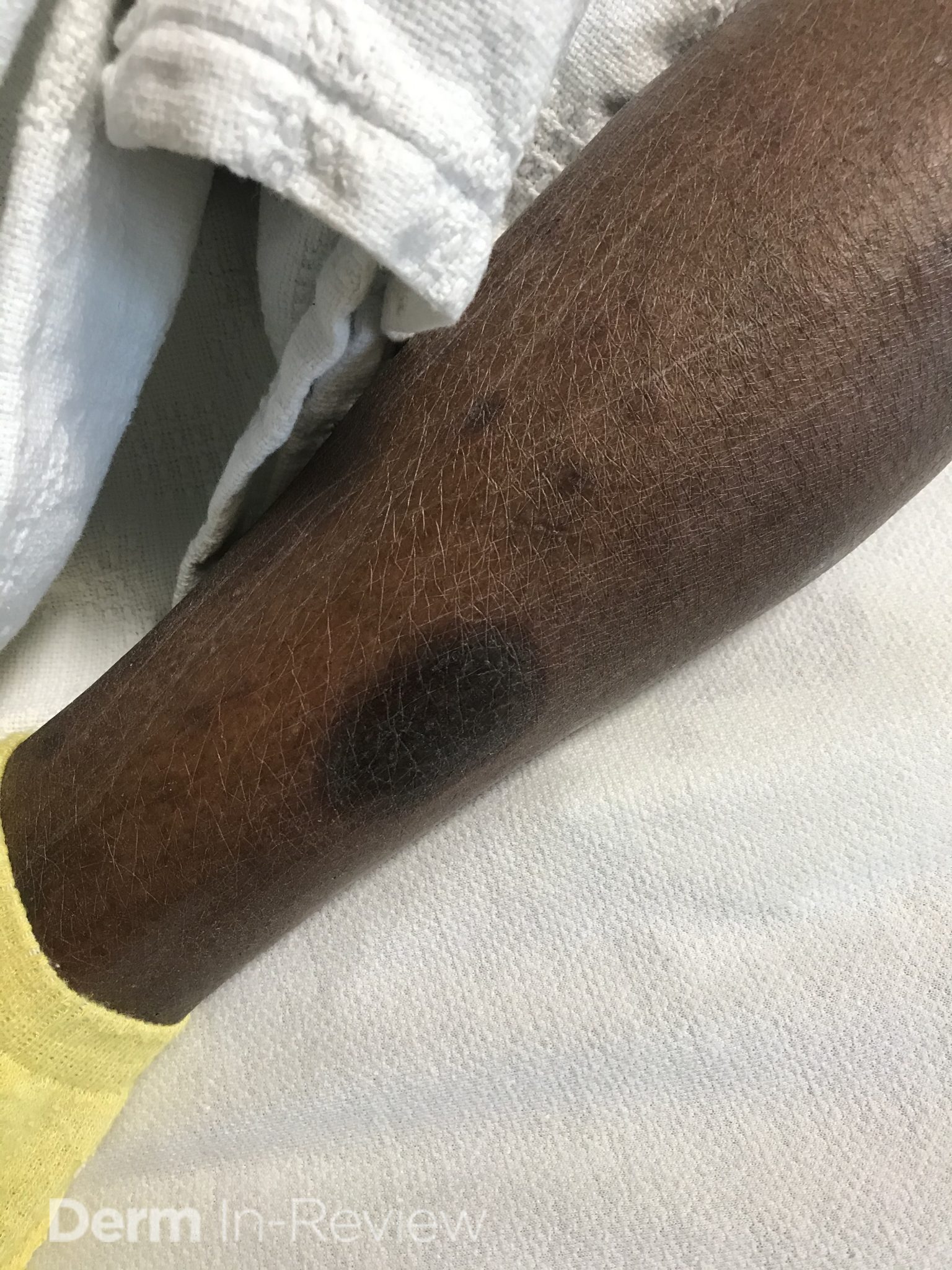 August 2025 Case Study – Derm In-Review