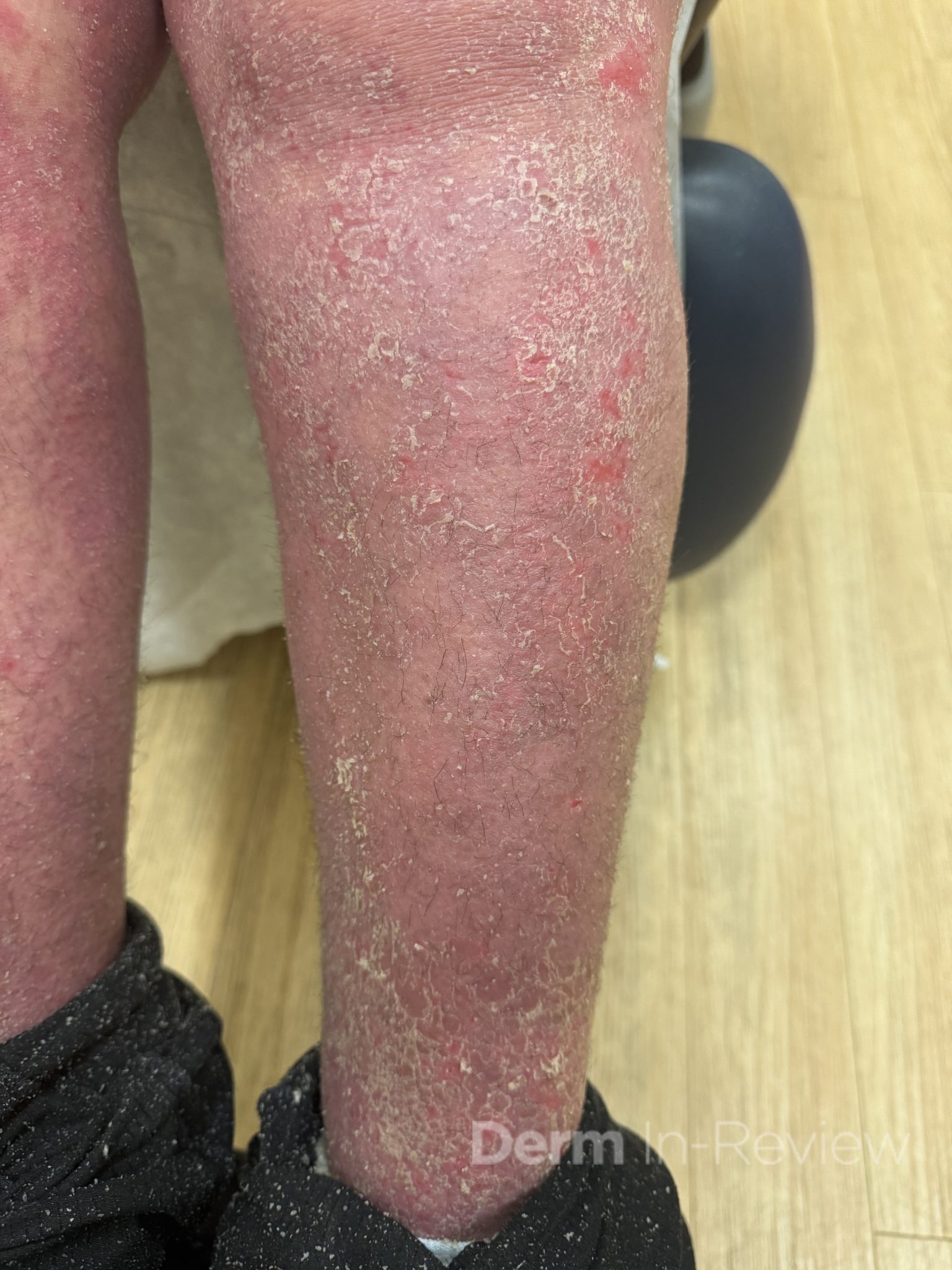 December 2025 Case Study – Derm In-Review